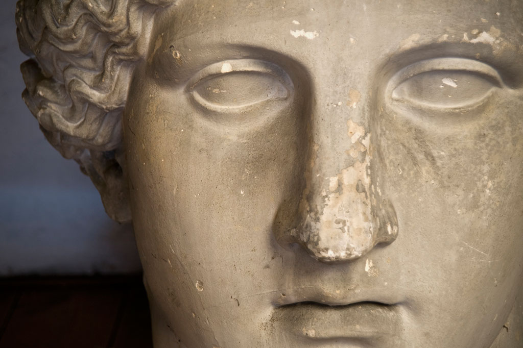 O que é a catalepsia? | Super